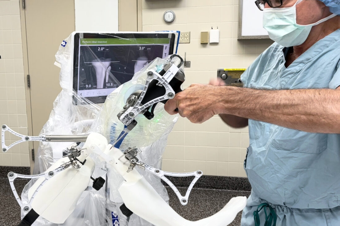 Robotic-assisted knee replacement now available at UPMC in North Central Pa. | News, Sports ...